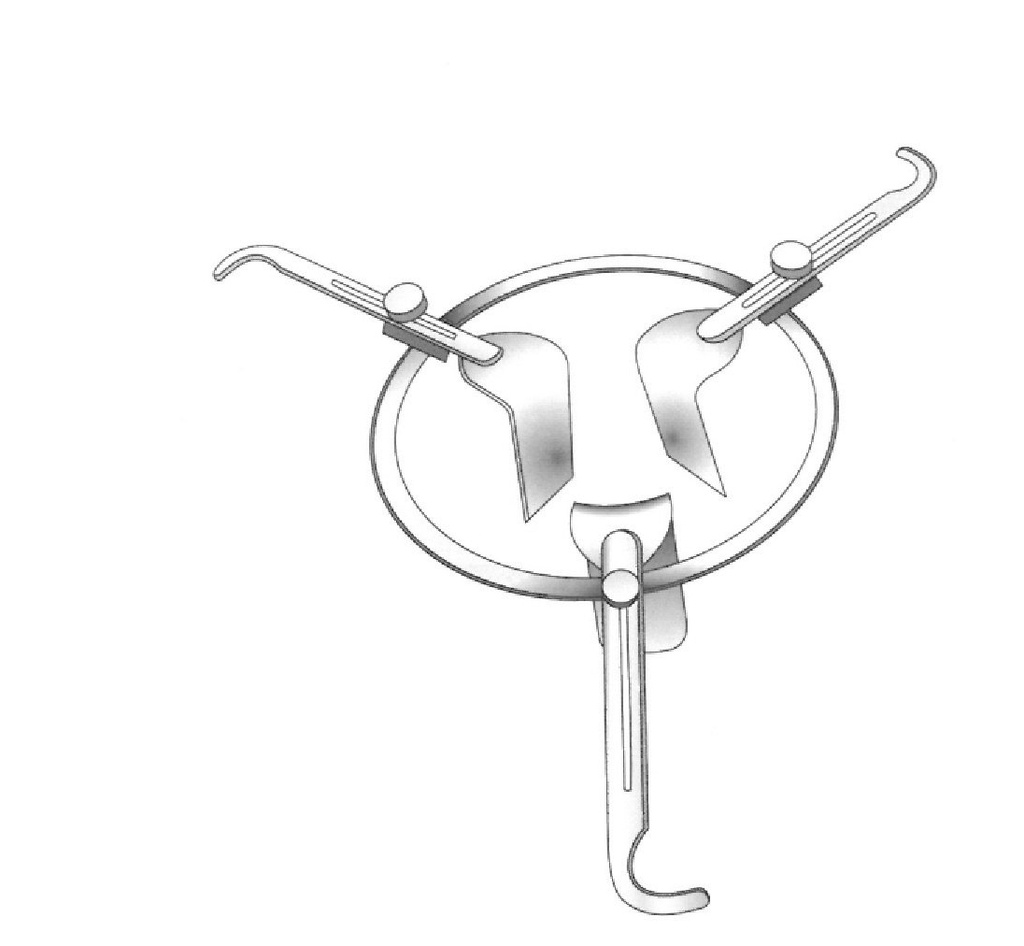 Retractor vaginal Smith | Surgicalmed.es